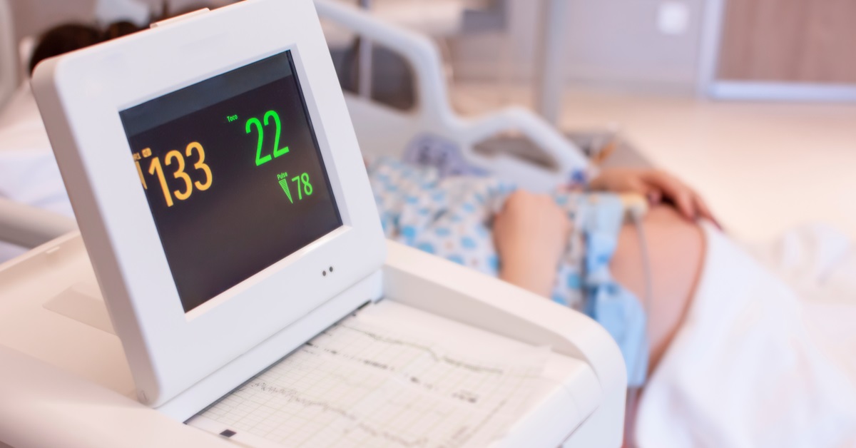 چیزهایی که در مورد NST باید بدانید